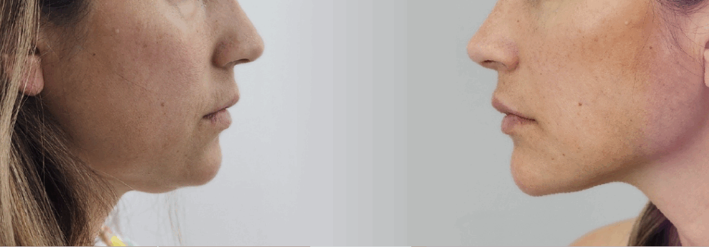 Clínica BeYou - Estética y dental